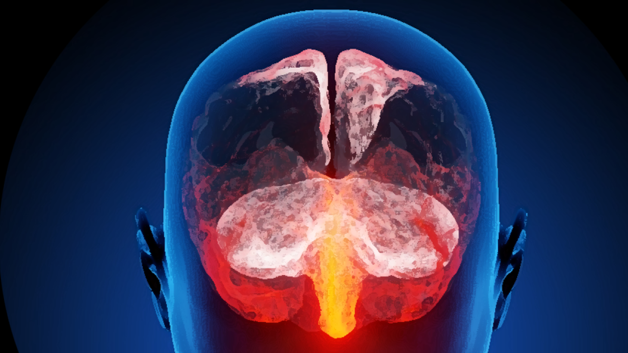 Neuroimmunology/Neurovirology | ucdneuro